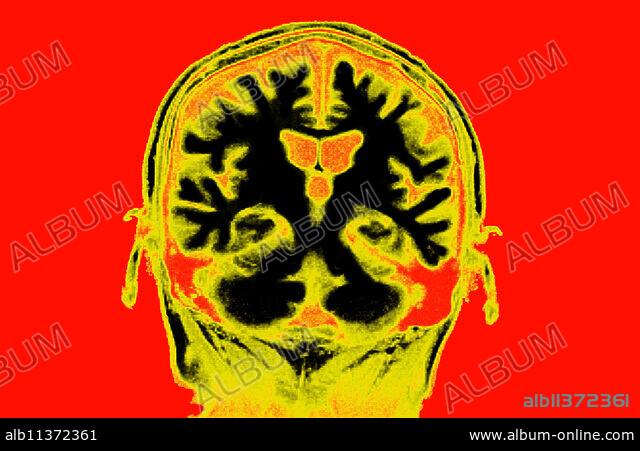 Nmr brain - Album alb11372361