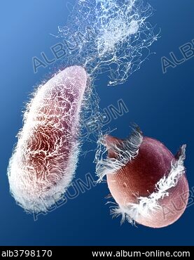 Didinium Under Microscope