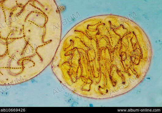 Nostoc Sob Microscopio Rotulado NOSTOC Stock Photos, Illustrations