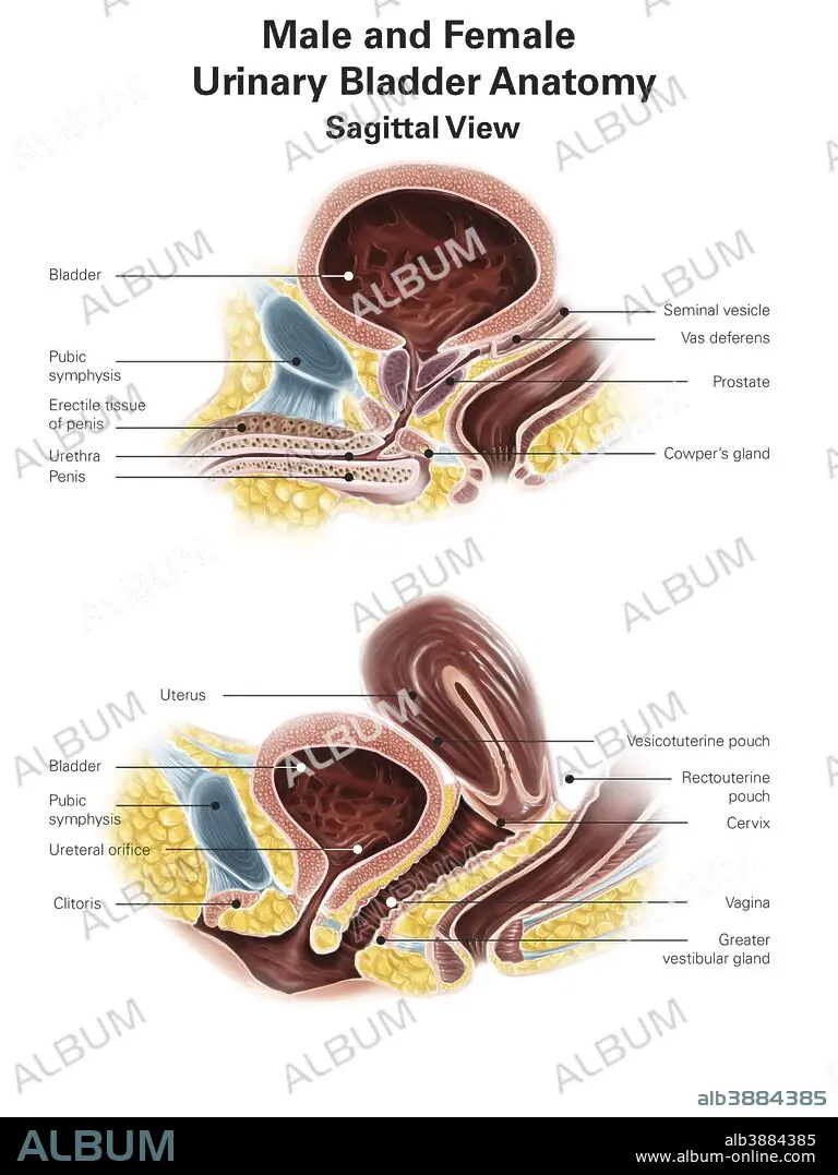 Urinary Bladder Male And Female Bladder Cancer – Urology Galway