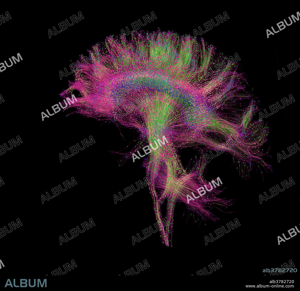 Dipy Diffusion Imaging In Python Open Source Imaging