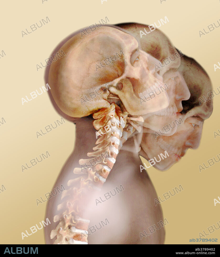 7th Cervical Vertebrae