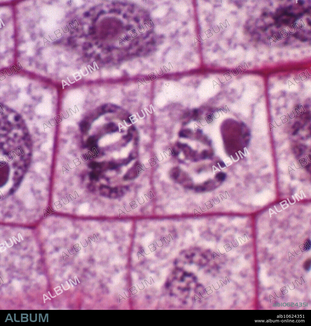 Cbse Class 12 Mitosis Onion Root Tip